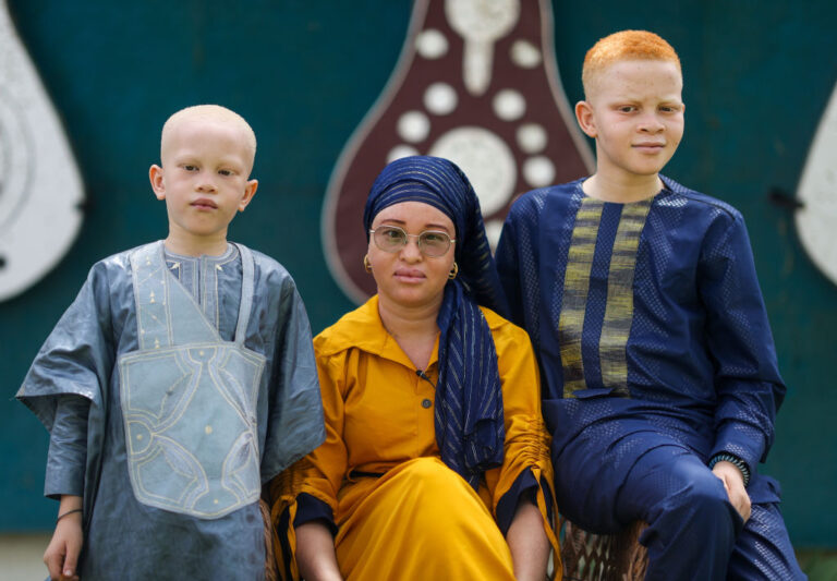 People with Albinism Face a Double Threat: Climate Change and ...