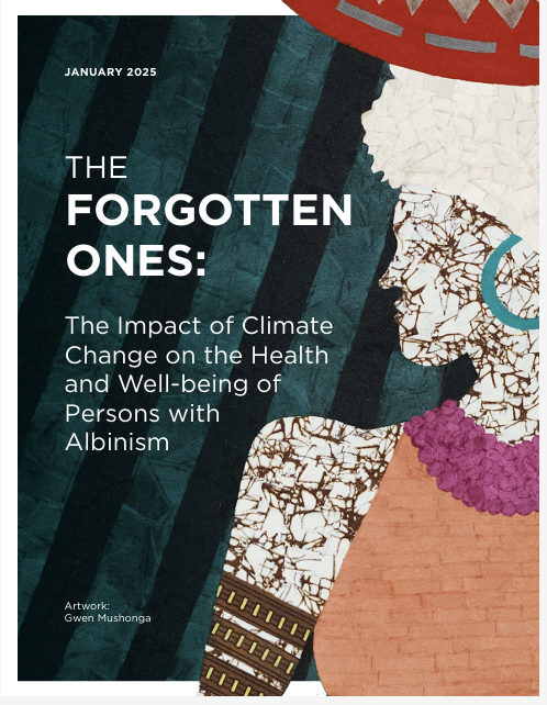 People with Albinism Face a Double Threat: Climate Change and ...